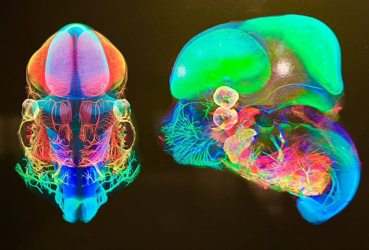 CEREBRO(S), una exposición que nos adentra en las dimensiones humanas ...